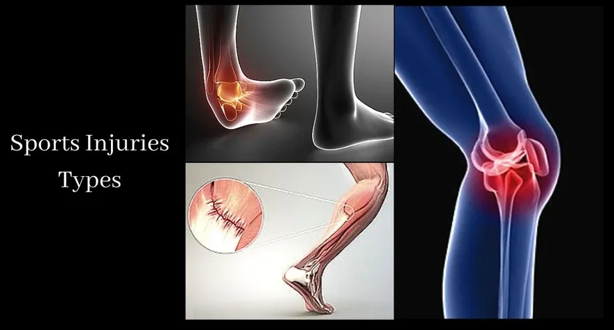 An overview of various Sports Injuries and their classification